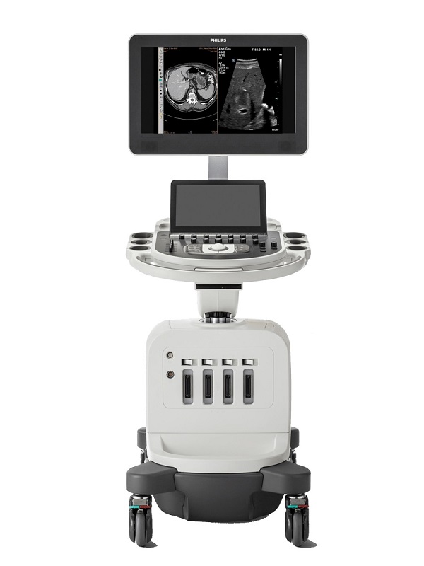 Philips Affiniti 70 - Refurbished Ultrasound - Diagnosis Corporate